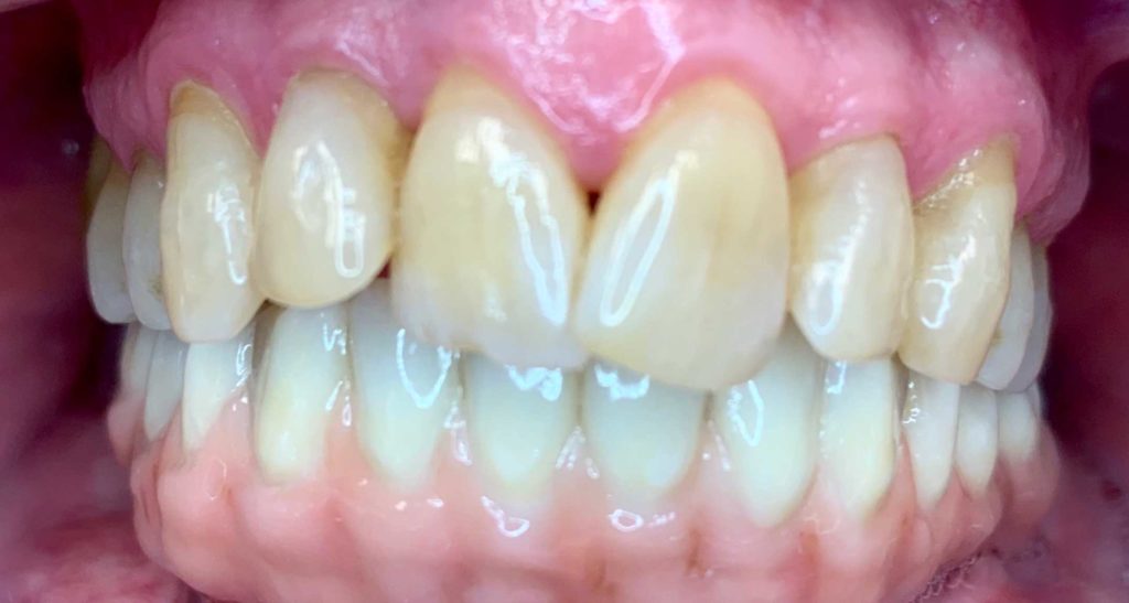 Smile Gallery - Durham Dental Solutions